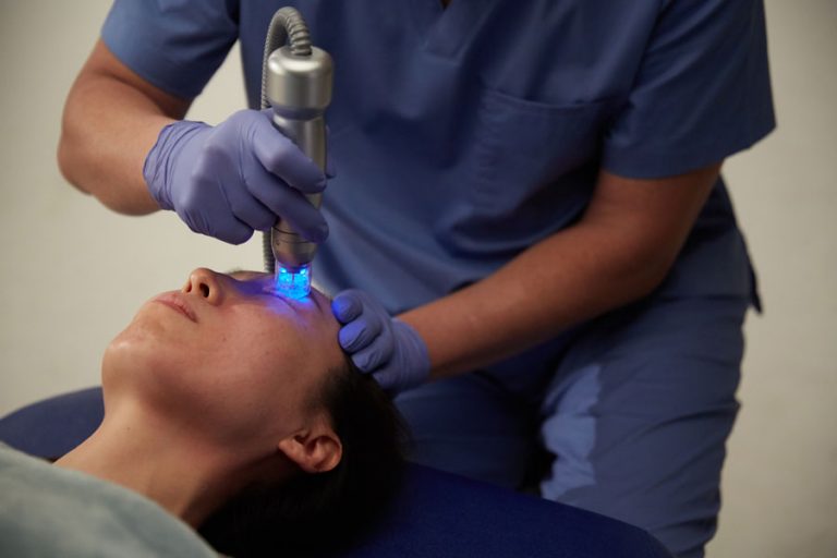 Scarlet RF Microneedling | RF Microneedling Benefits of Scarlet